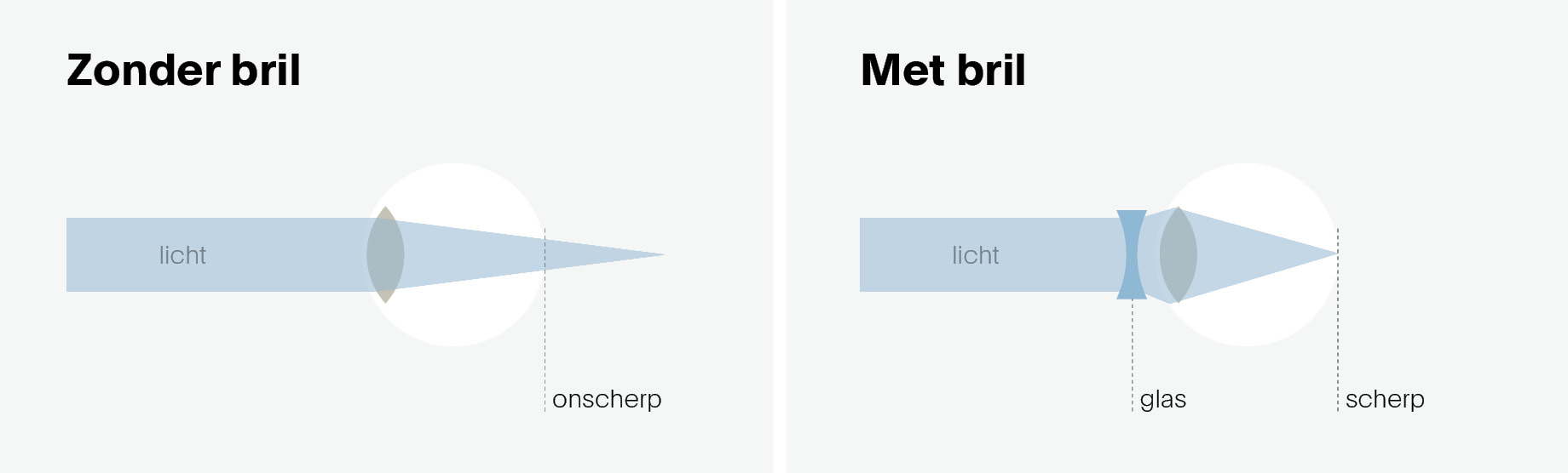 Verziend (Hypermetropie) | Pearle Opticiens